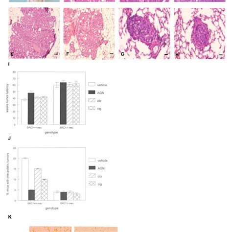 Increased Tumor Latency And Decreased Metastasis In Oncogene Induced