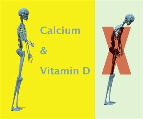 Why Calcium And Vitamin D Are Essential For Bone Health