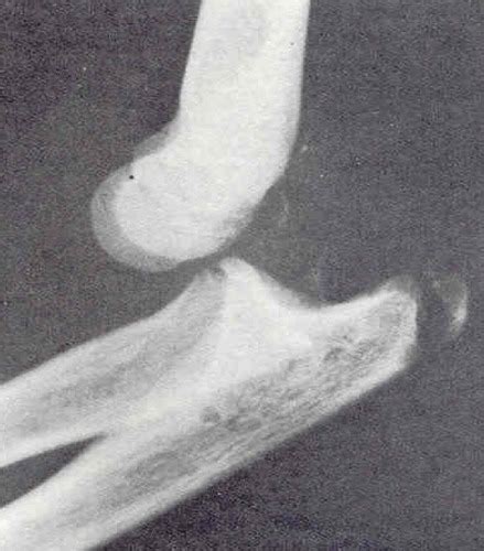 Pathophys General Principles Flashcards Quizlet