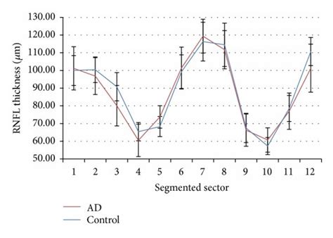 Mean Data Of Rnfl Thickness Against Eye Quadrants Assessed With Optical Download Scientific