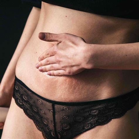 Proliferative Endometrium Treatment 5 Powerful Steps 2025