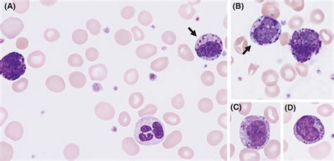 Basophilic Myelocyte