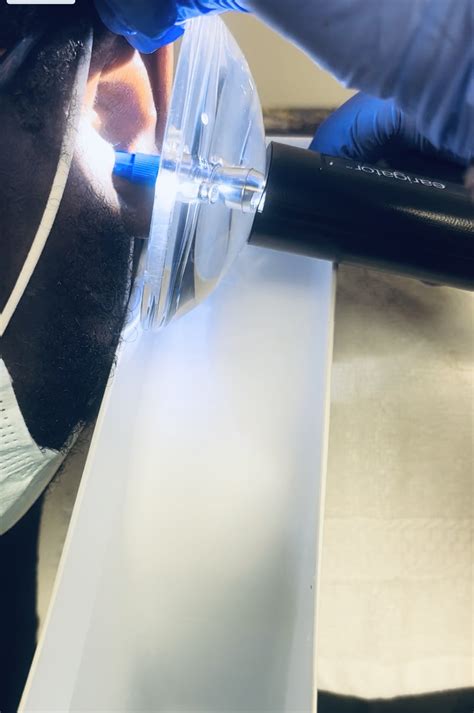 What Is Ear Irrigation Oracle Hearing