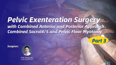 Pelvic Exenteration Surgery With Combined Anterior And Posterior