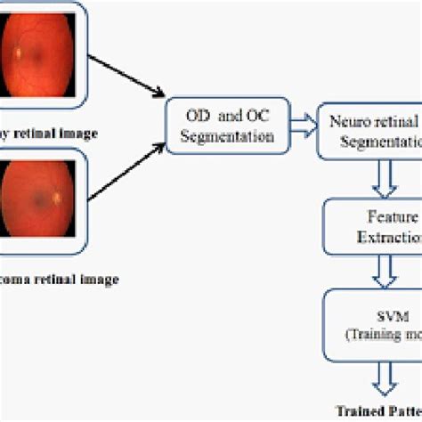 PDF An Efficient Detection System For Screening Glaucoma InRetinal Images