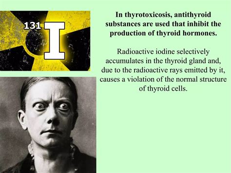 Hypo And Hyperthyroidism Pptx