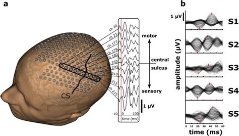How Ultra High Density Brain Recordings Can Map The Central Sulcus