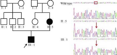 pedigree and sequence electropherogram partial sequences of sall1 show