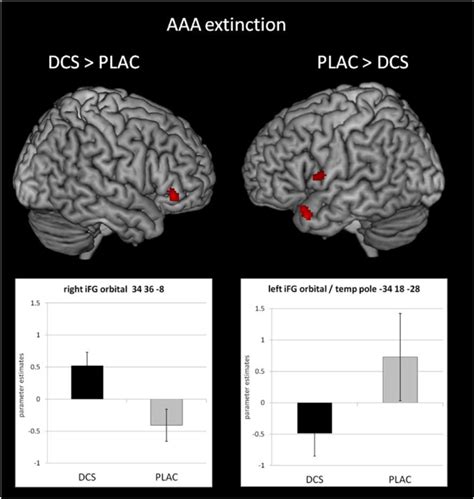 Double Dissociation Of Activation In Bilateral Ifg Derived From The