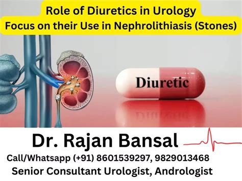 Role Of Diuretics In Urology Focus On Their Use In Nephrolithiasis