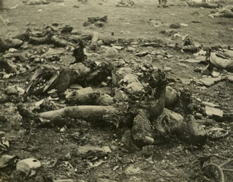 Mutilated Body Parts