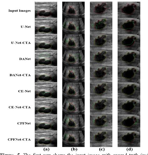 Figure 1 From Classification Task Assisted Segmentation Network For