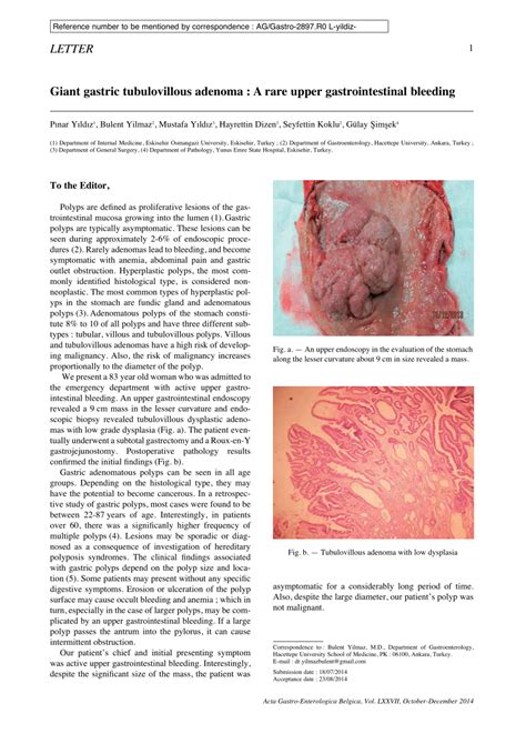 Pdf Giant Gastric Tubulovillous Adenoma A Rare Upper