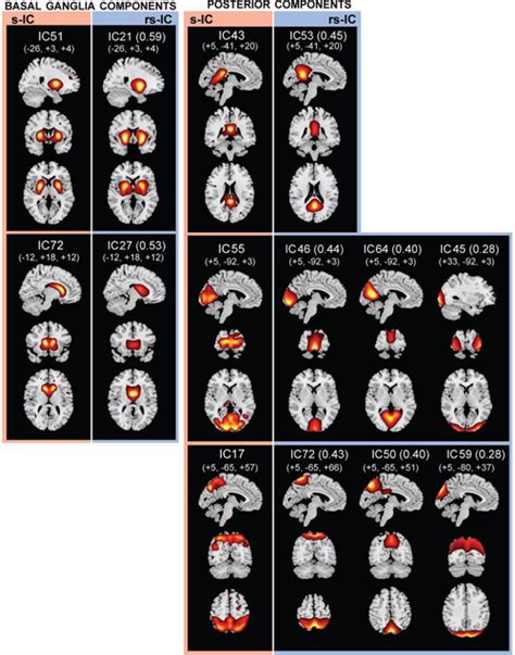 The Structural Smri Components Red And Corresponding Rs Fmri