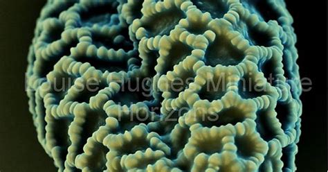 Pollen Under An Electron Scanning Microscope Album On Imgur