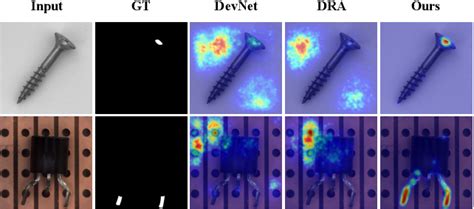 Prototypical Residual Networks For Anomaly Detection And Localization