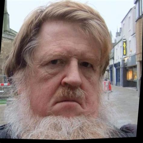 Dark Circle Object Detection Dataset And Pre Trained Model By Acne Detection