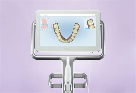 Itero Customer Learning Center Na Itero Element 2 Imaging System