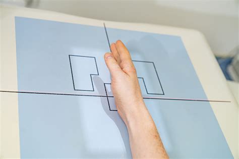 Modern Hospital Radiology Equipment Clinical Xray Diagnostic Device