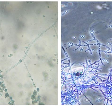 Pdf Trichoderma A Beneficial Antifungal Agent And Insights Into Its