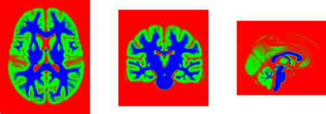 Template Generated From Fitting The Generative Model To All Of The Download Scientific Diagram