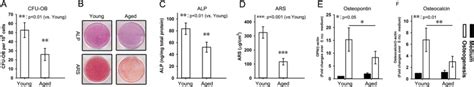 Hdac6 Inactivates Runx2 Promoter To Block Osteogenesis Of Bone Marrow Hdac6 Inactivates Runx2 Promoter To Block Osteogenesis Of Bone Marrow