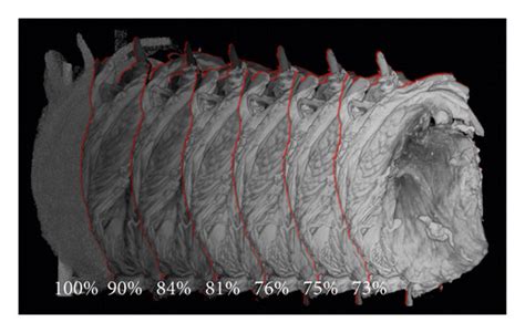 Soft Tissue Shrinkage At Increasing Concentrations Considerable