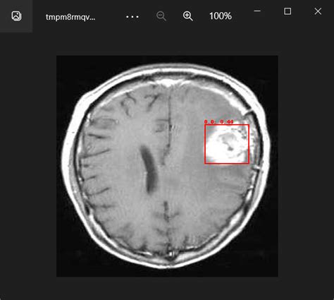 Tutorial Object Detection Brain Tumor Mri Menggunakan Yolo You Only