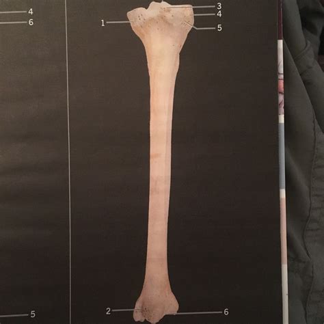 Right Tibia Posterior View Lab Book Practical 1 Diagram Quizlet