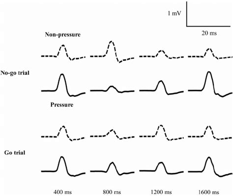 Typical Averaged Mep Waveforms Of The Apb With Four Different Ws Tms