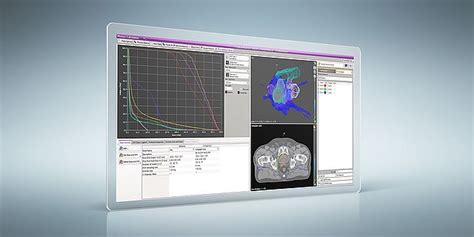 Radcalc Dosimetric Verification Software Lap