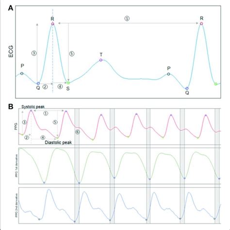 Waveform Feature Analysis For Ecg And Ppg A An Exemplary Ecg Download Scientific Diagram