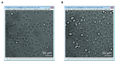 Examples Of Cell Densities In A Microscopic Field For Imaging In Download Scientific Diagram