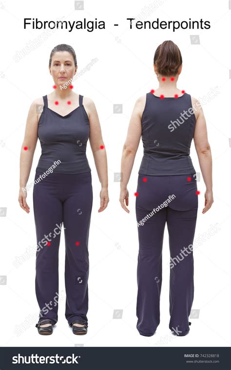 5 Common Trigger Points Royalty Free Photos And Stock Images Shutterstock