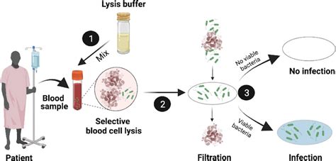 Sepsis Cascade Made Easy