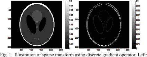 Figure 1 From Anisotropic Total Variation For Limited Angle Ct Reconstruction Semantic Scholar
