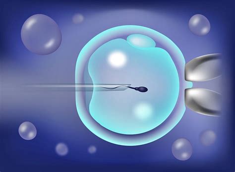 Icsi Opportunities And Risks Of Fertility Treatment