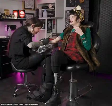 Ruth Codd Reveals She Has Undergone Second Leg Amputation To Improve