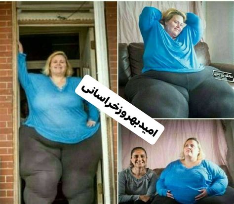 خبر تازه زنی با بزرگترین باسن جهان😲😮 زن 42 ساله با 500 Facebook