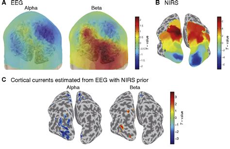 Figure 1 From Decoding Spatial Attention By Using Cortical Currents