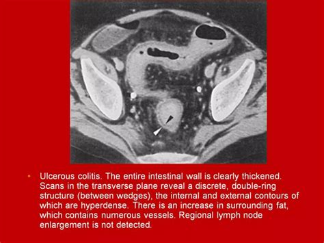 Whole Body Computed Tomography Git Pptx Obscenity And Profanity Sensitive Topics
