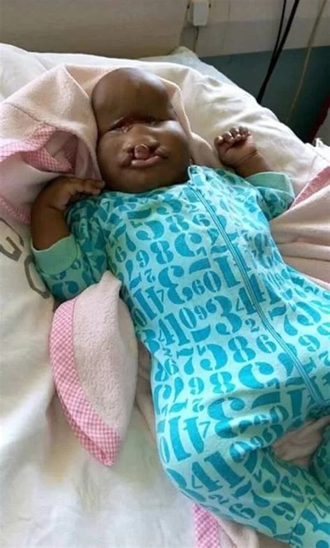 Newborn With Big Head At Nicholas Margarot Blog