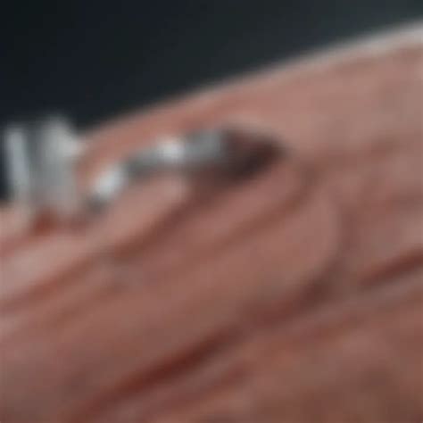 Understanding Septic Bursitis A Comprehensive Overview