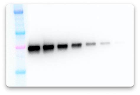 Azure Ultimate Western Blot Imager Azure Biosystems