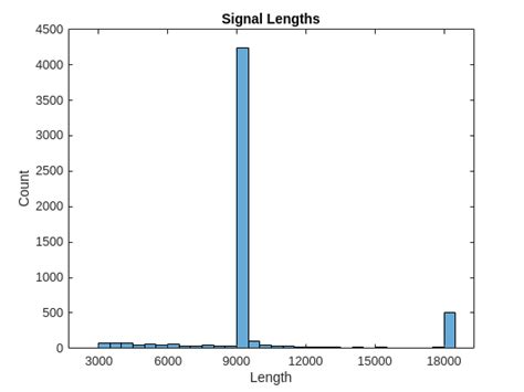 Classify Ecg Signals Using Long Short Term Memory Networks Matlab And Simulink