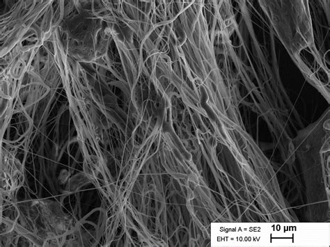 Nanofibrous Scaffolds Sem Gallery Kdbio Productivity Tools For Life Science Labs
