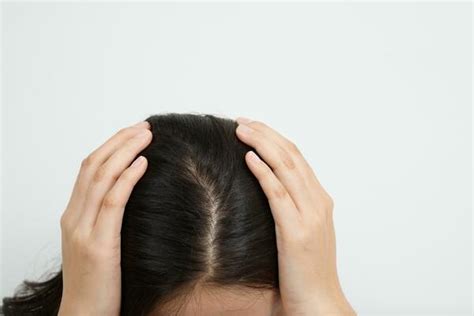 Scalp Stock Photos Images And Backgrounds For Free Download
