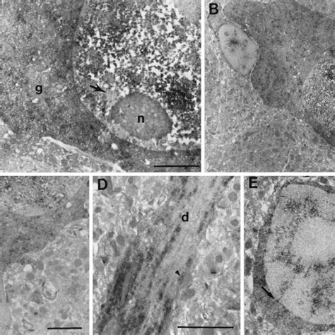 Ultrastructural Localization Of Polya Mrna In Cell Bodies And