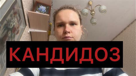 Кандидоз Youtube