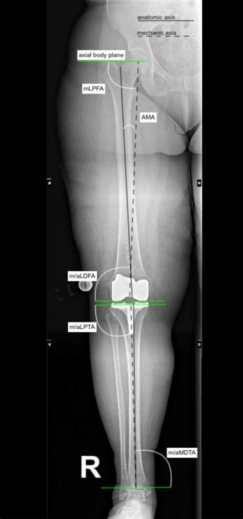 Imaging References Illustrating The Main Axes And Reference Angles Download Scientific Diagram